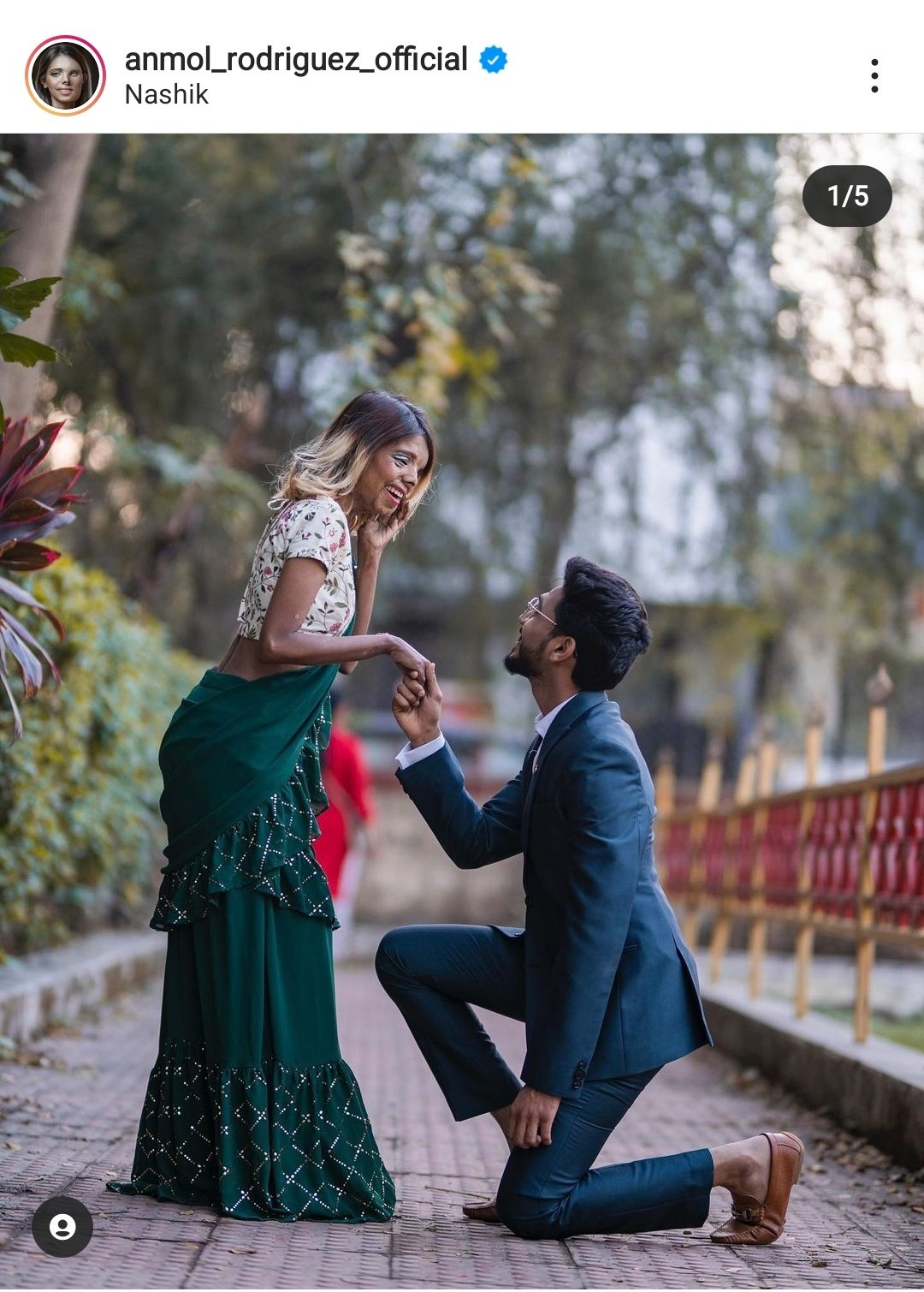 Gdy miała 2 miesiące, ojciec oblał ją i jej matkę kwasem. Teraz Anmol ...