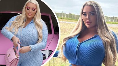 Przez swoje walory nie mieści się do samochodu! Na operacje plastyczne ...